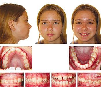 Office Visit: Dr. Josh Gilbert by Kyle Patton - Orthotown