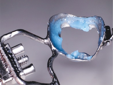 Bonding Rituals by Paul Gange Jr. - Orthotown