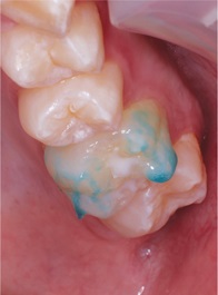 Bonding Rituals by Paul Gange Jr. - Orthotown