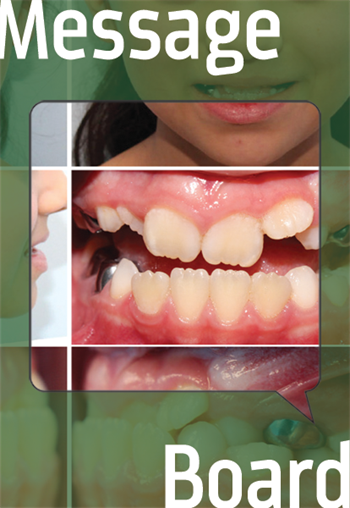 Phase 1: Anterior Crossbite and Crowding - Orthotown