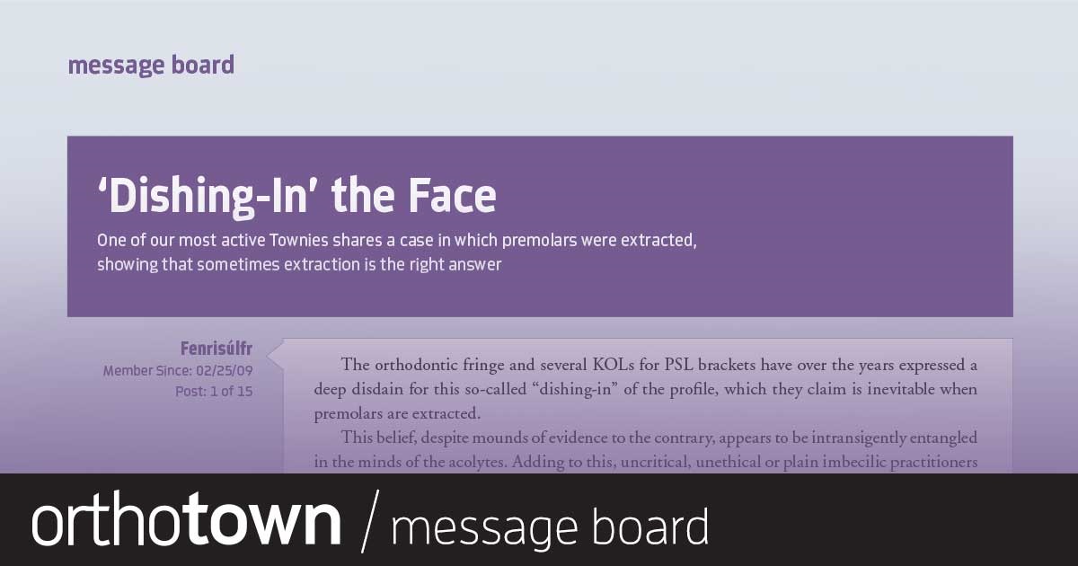 ‘Dishing-In’ the Face - Orthotown